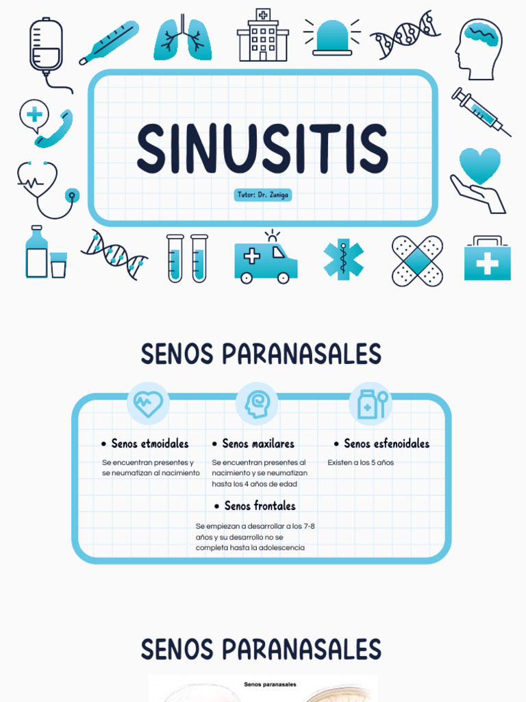 Sinusitis Aguda: Diagnóstico y Tratamiento | PDF | Inmunología ...