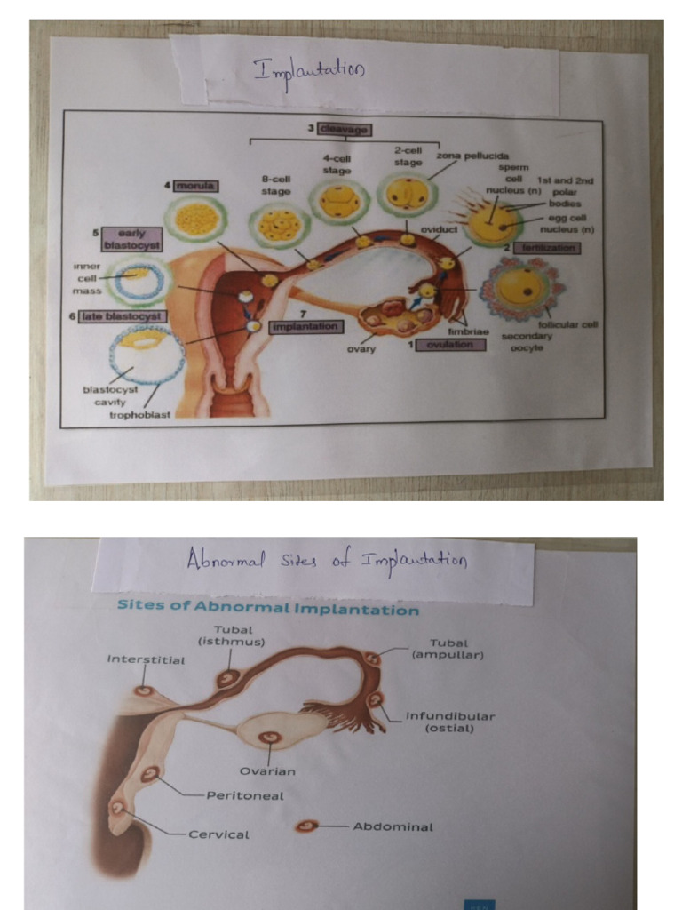 7.emb Charts Gmcs | PDF
