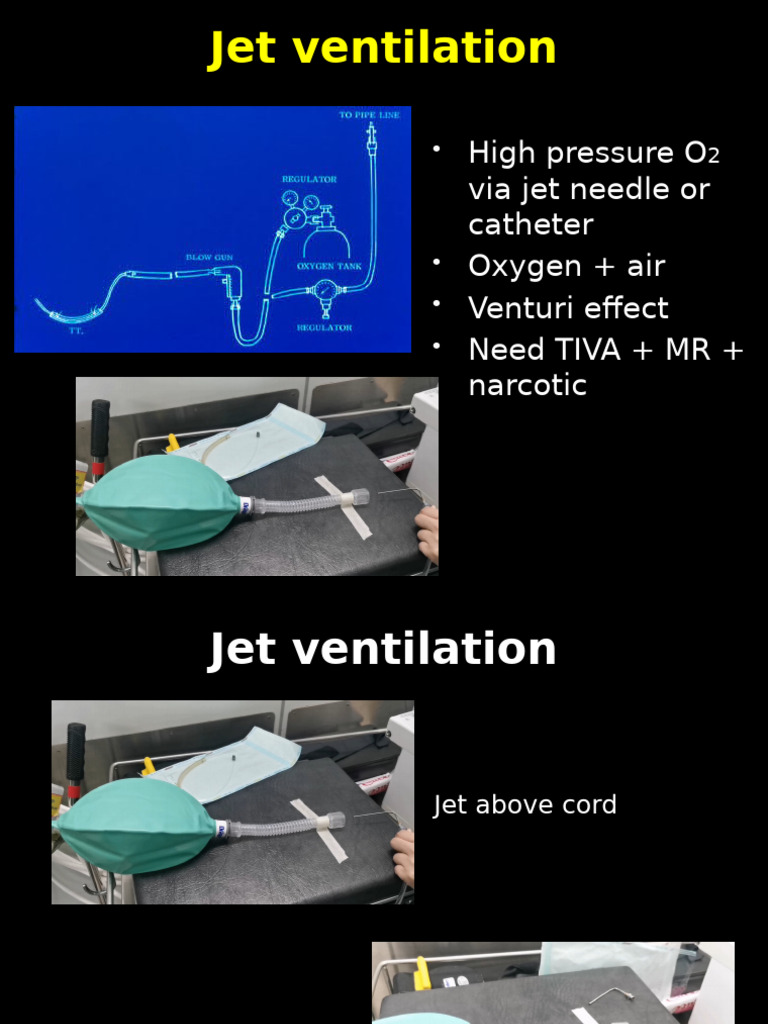 Jet Ventilator 2567 | PDF