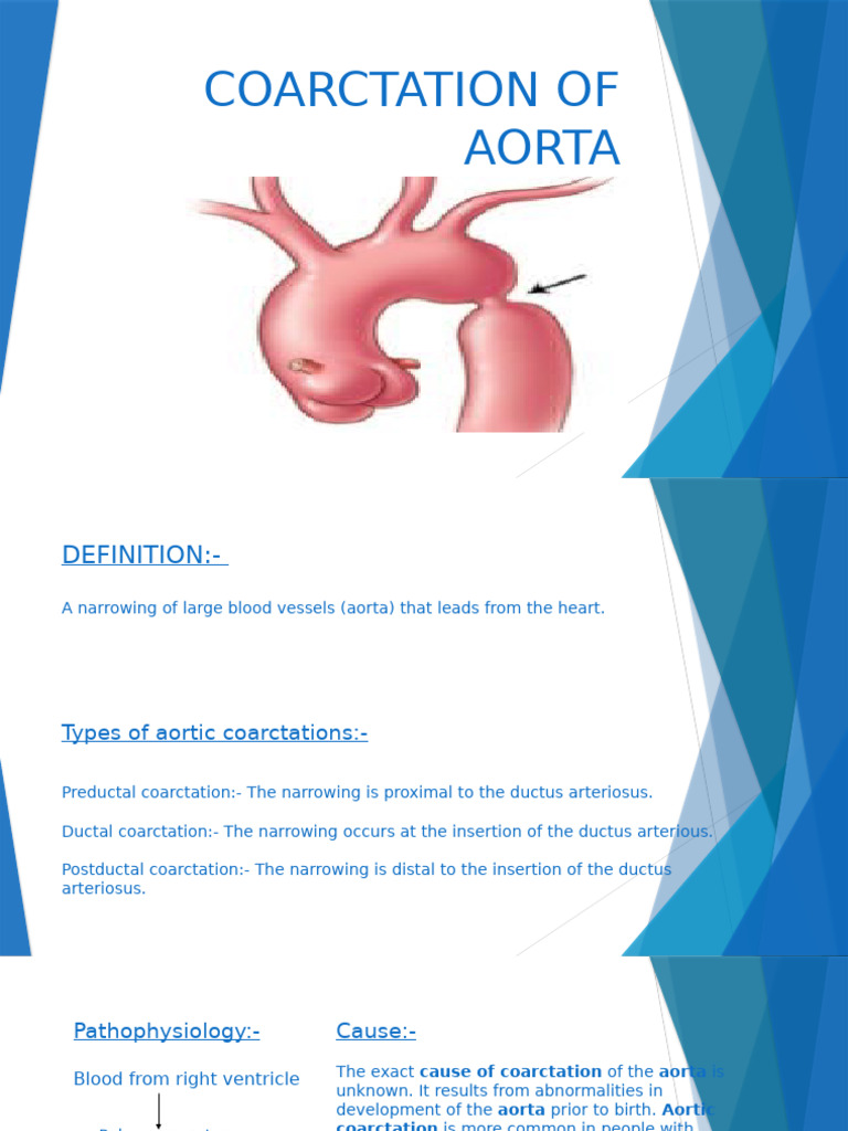 Coarctation of Aorta | PDF