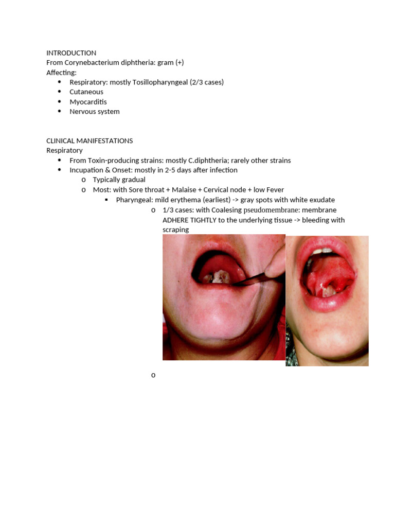 Diphtheria: Symptoms and Effects | PDF
