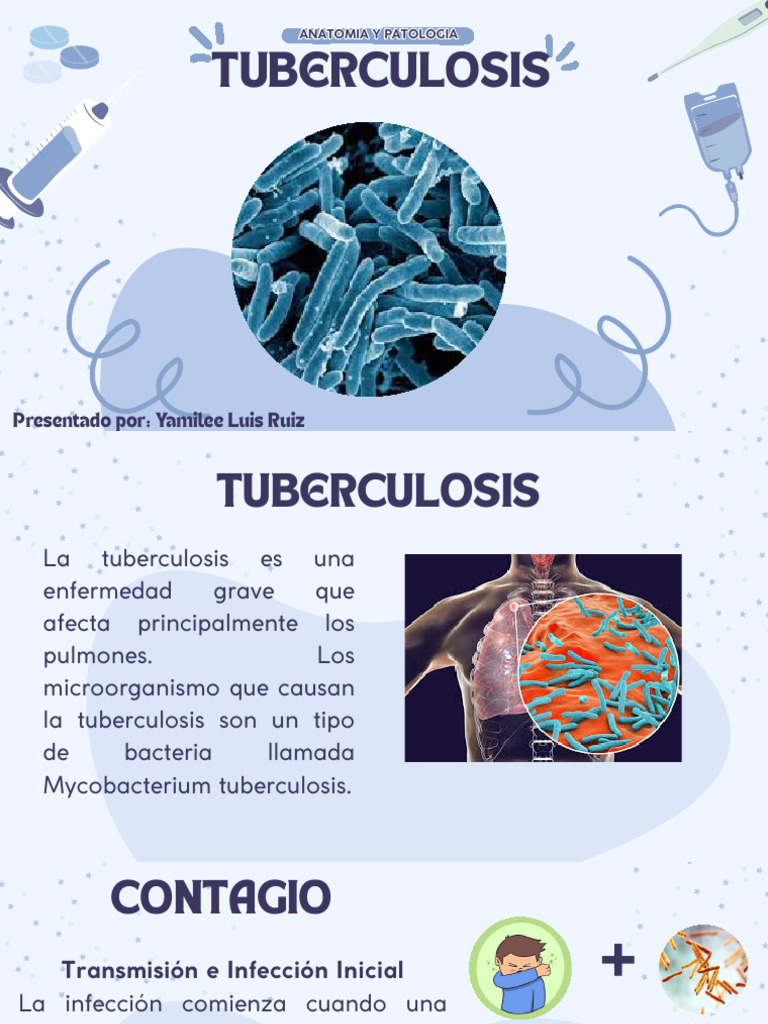 Tuberculosis: Anatomía, Patología y Tratamiento | PDF | Tuberculosis ...