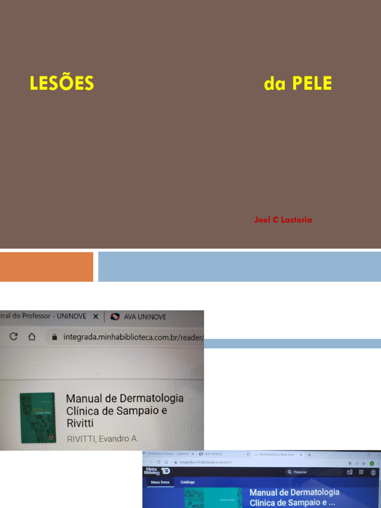 Lesões Elementares da Pele: Tipos e Causas | PDF | Pele | Neoplasmas