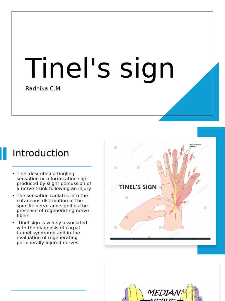 Tinels Sign | PDF