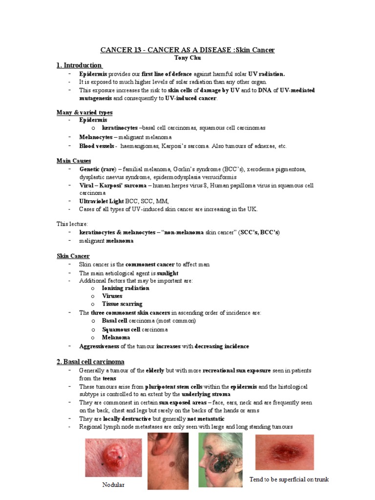 Cancer 12 Cancer As A Disease Skin Cancer | PDF | Apoptosis | Ultraviolet