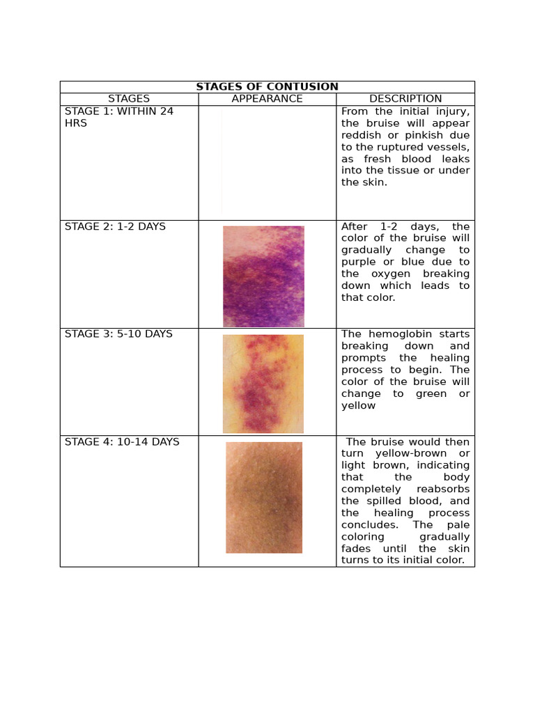 Forensic Medicine Stages of Contusion | PDF