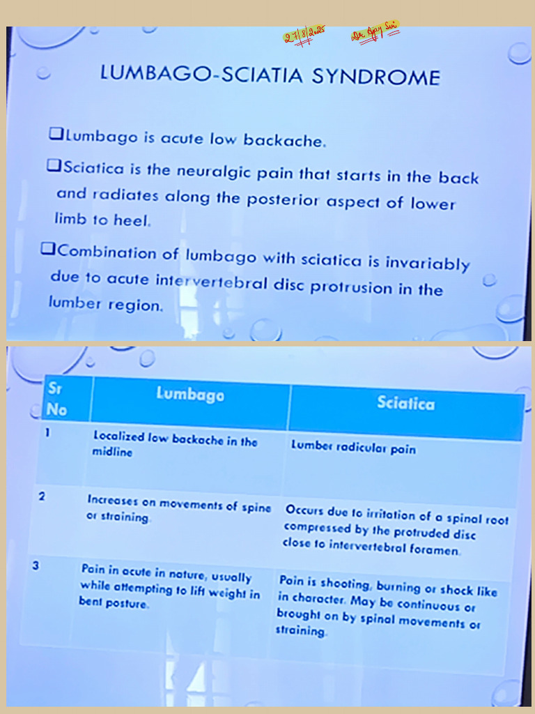 Lumbago Sciatica Syndrome | PDF