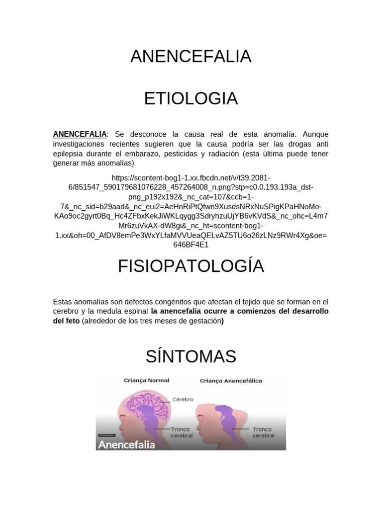 ANENCEFALIA Maria Alejandra Abaunza Sarmiento | PDF | Órgano (anatomía ...