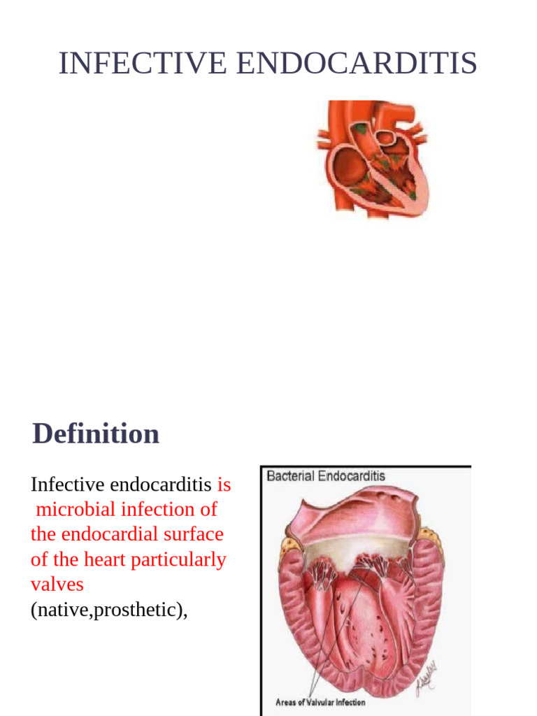 Infective Endocarditis Meda | PDF | Streptococcus | Cardiovascular System