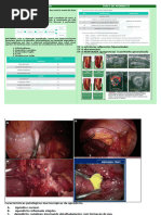 Anatomia e Funções do Apêndice Vermiforme | PDF | Doenças e distúrbios ...