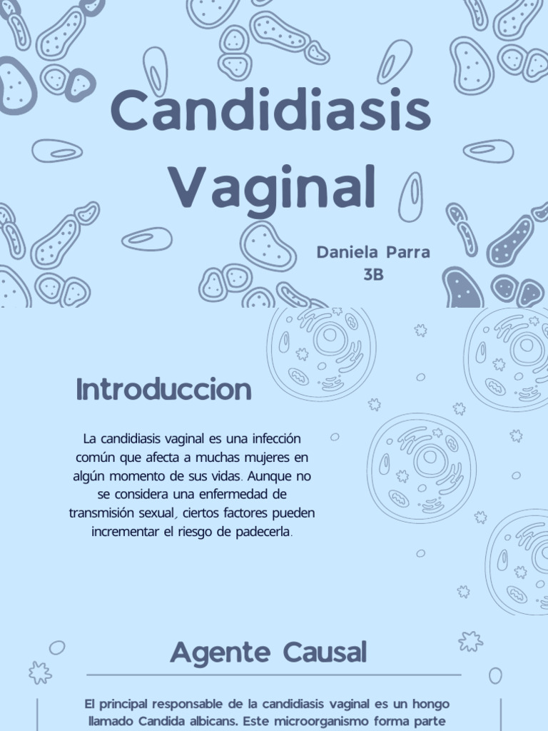 Candidiasis Vaginal: Causas y Tratamiento | PDF | Candidiasis ...