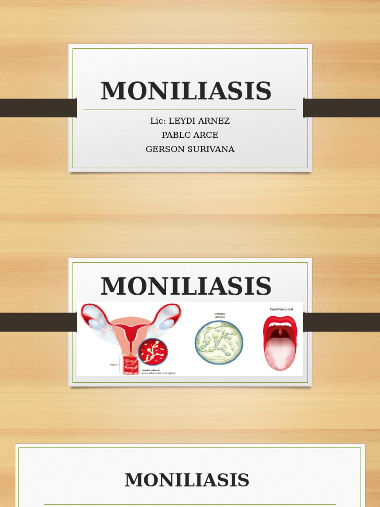 MONILIASIS | PDF