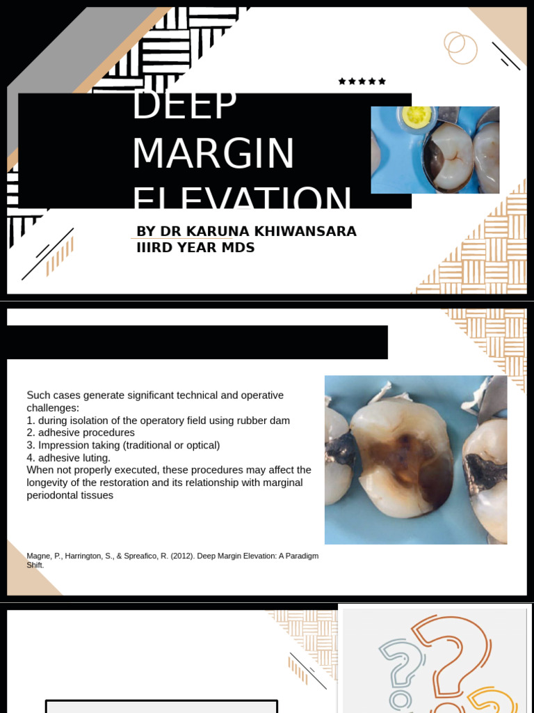 Deep Margin Elevation in Dentistry | PDF | Periodontology | Dentistry ...