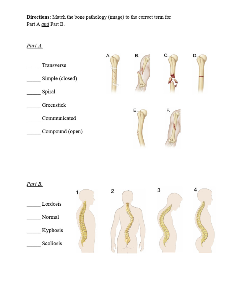 Bone & Spine Match | PDF