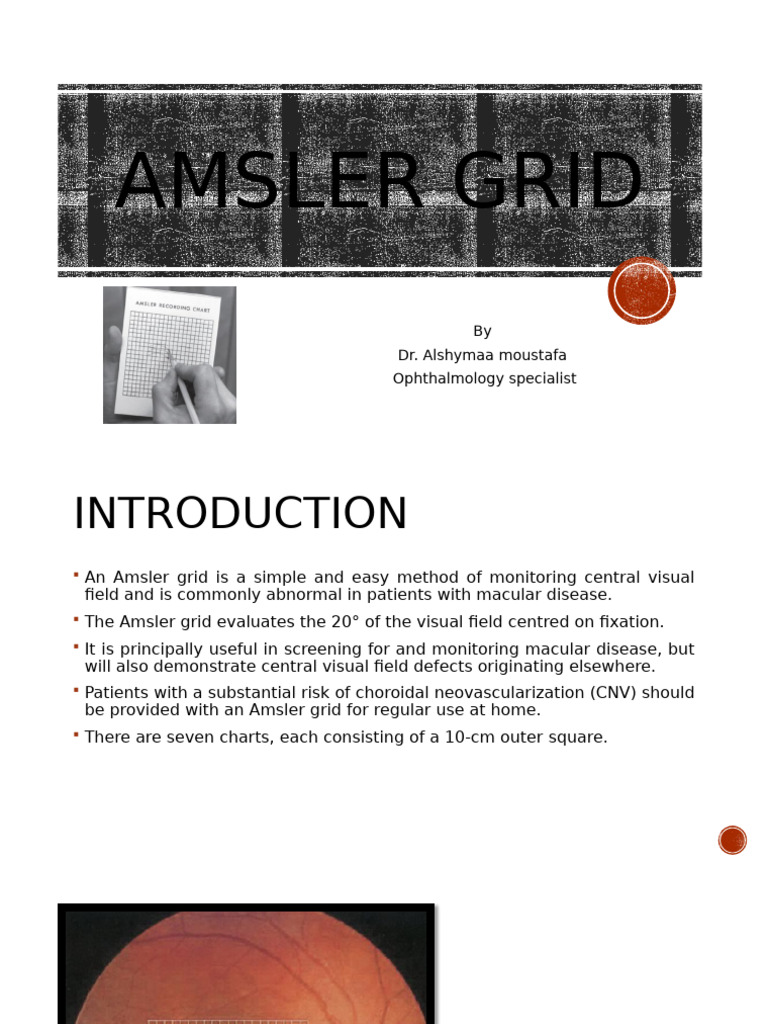 Amsler Grid | PDF | Vision | Ophthalmology