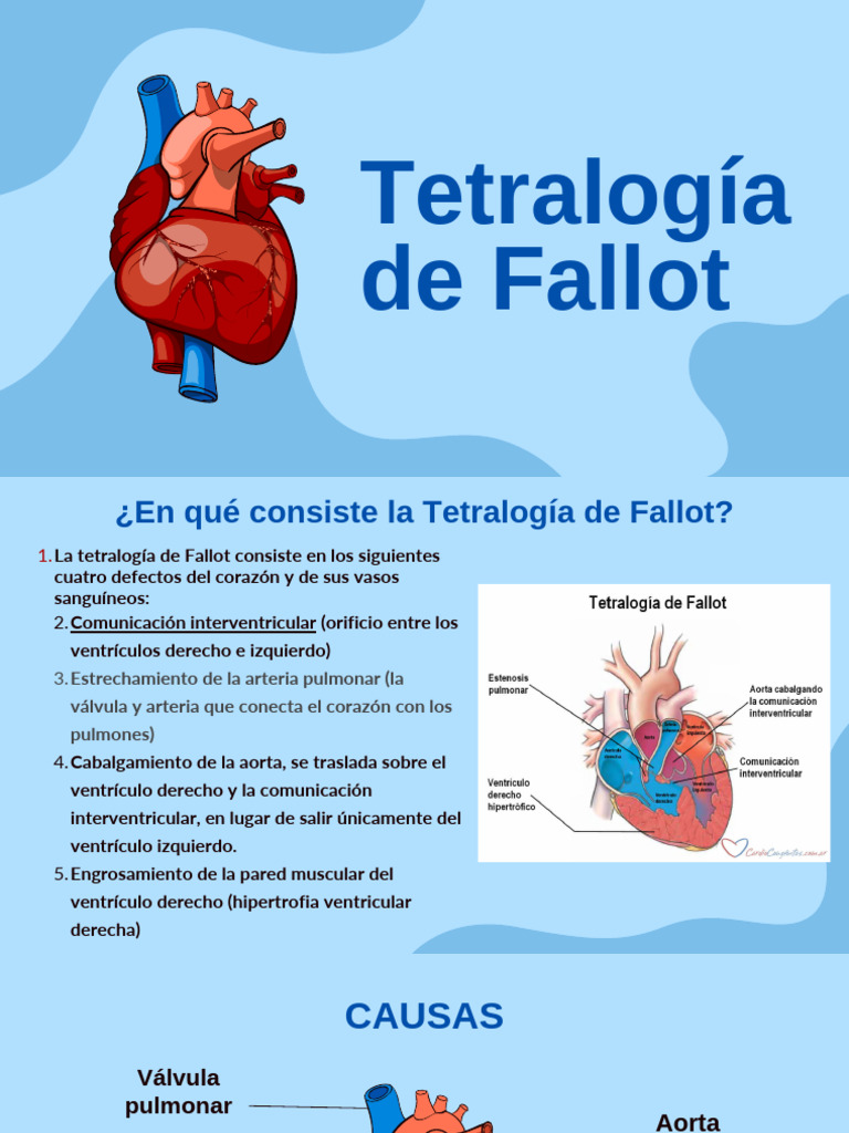 Tetralogia de Fallot | PDF | Corazón | Ventrículo (corazón)