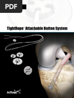 Acl Tightrope Attachable Button System | PDF | Musculoskeletal System ...