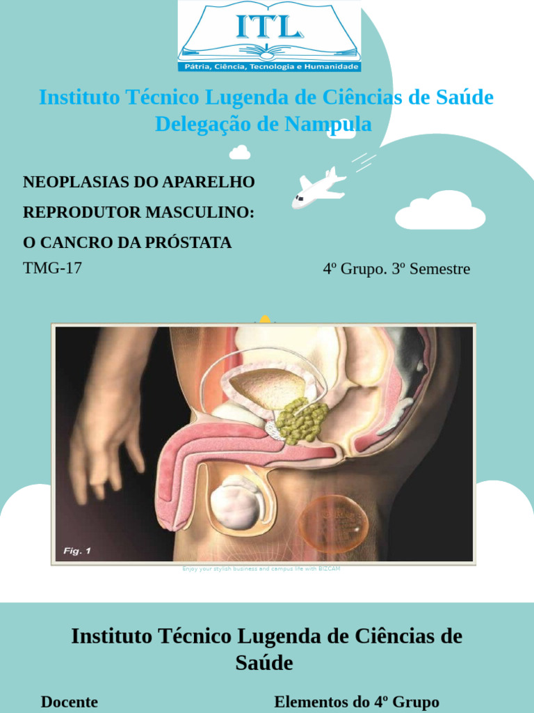 Apresentação Hematologia e Oncologia (Cancro Da Próstata) 2.0 | PDF ...