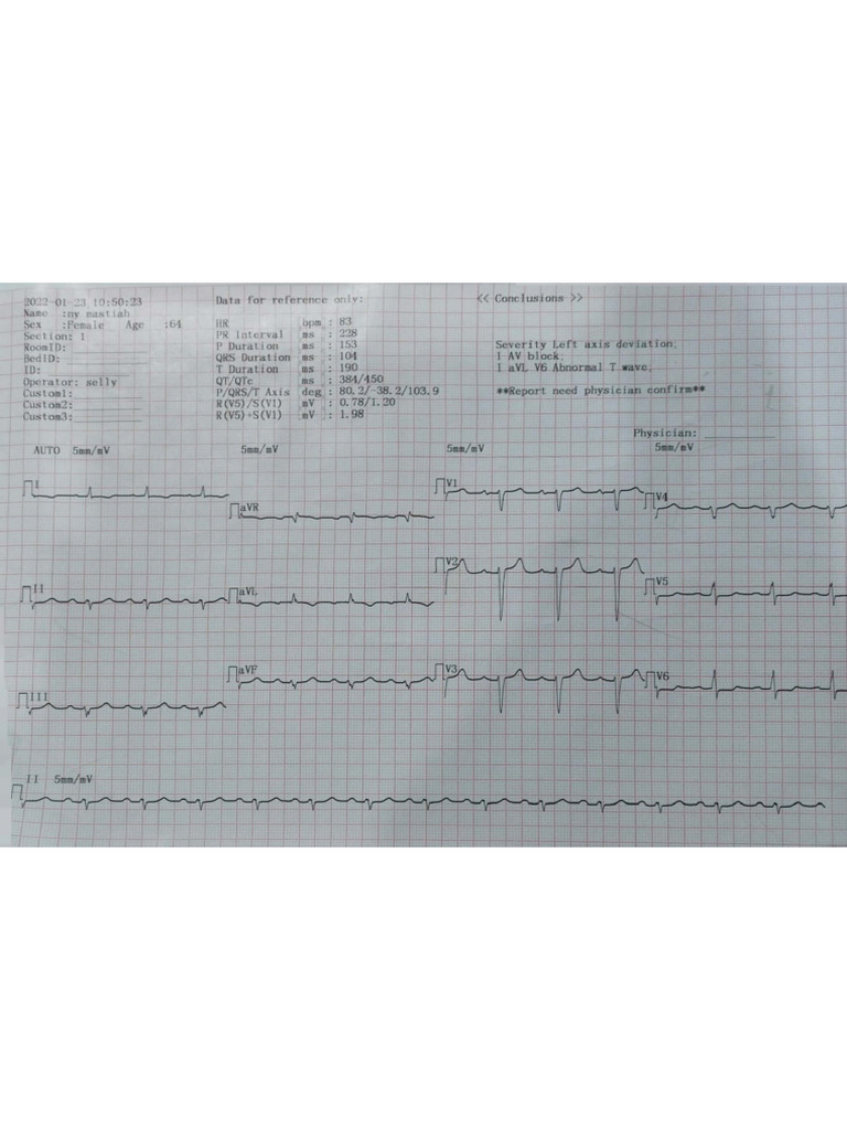 Ekg Ny. Mastiah | PDF