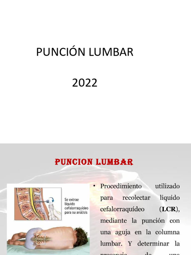 Puncion Lumbar | PDF