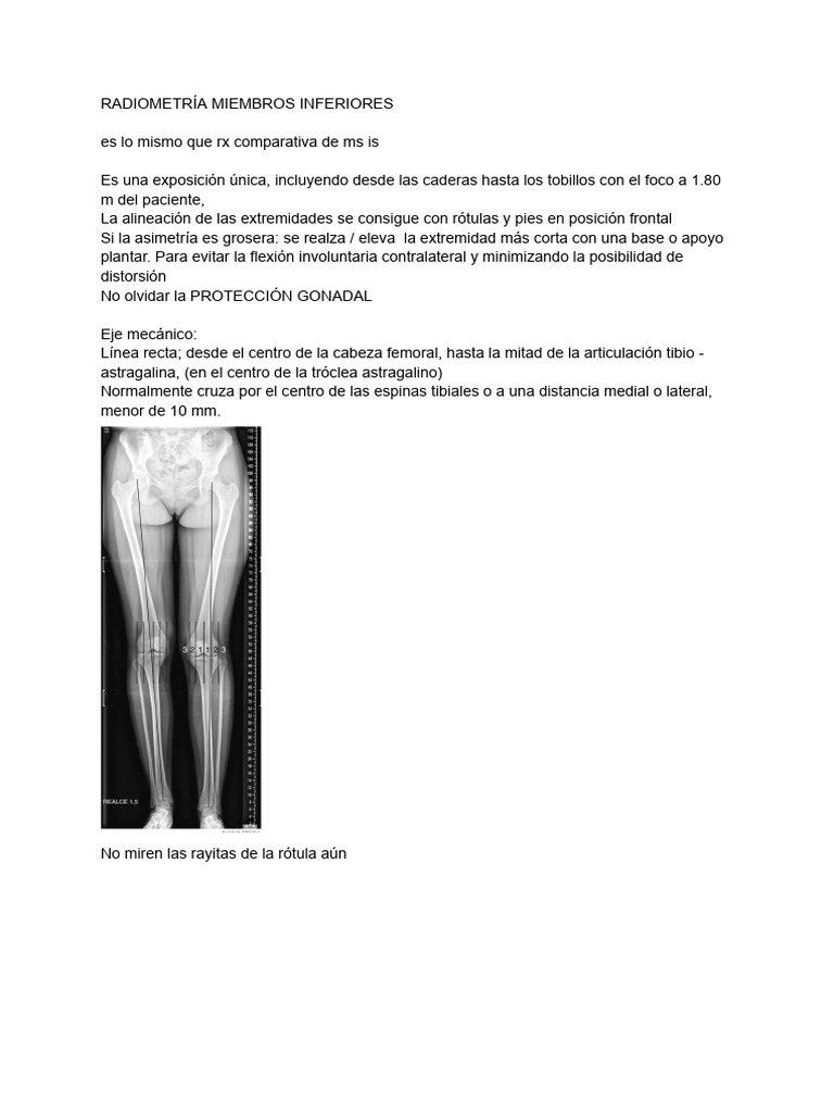 RADIOMETRÍA MIEMBROS INFERIORES by JONY | PDF | Sistema esquelético ...