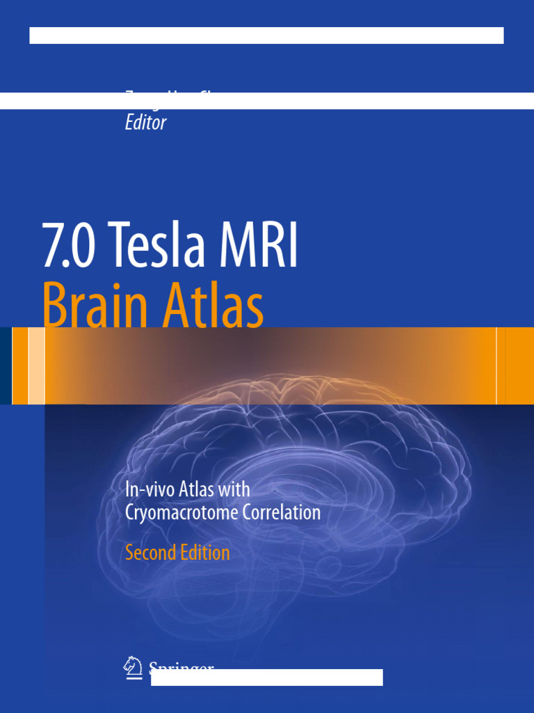 7.0 Tesla MRI Brain Atlas (In-Vivo Atlas With Cryomacrotome Correlation ...