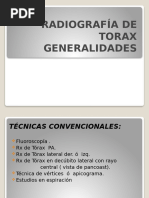 Radiografía de Tórax Normal - Patrón Intersticial | PDF | Pulmón | Tórax