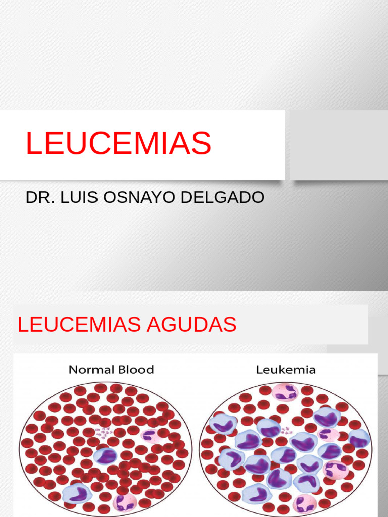Leucemias 2024 7 Ciclo | PDF | Leucemia | Sangre