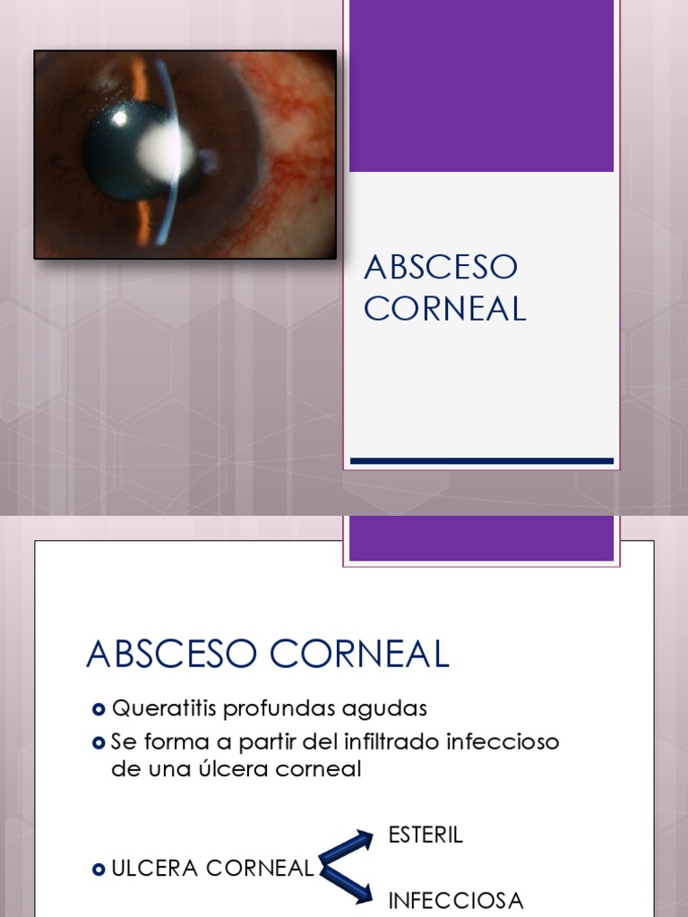 Absceso Corneal | Córnea | Inflamación