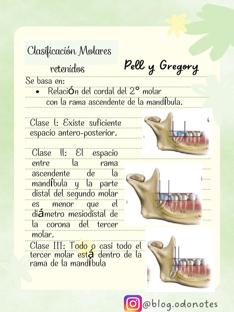 Clasificacion de Pell y Gregory | PDF