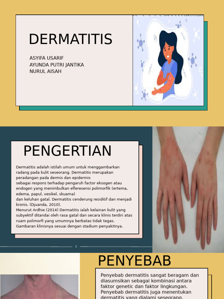 Ppt Dermatitis | PDF