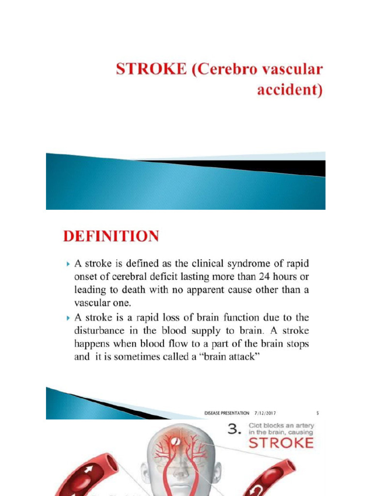 STROKE | PDF