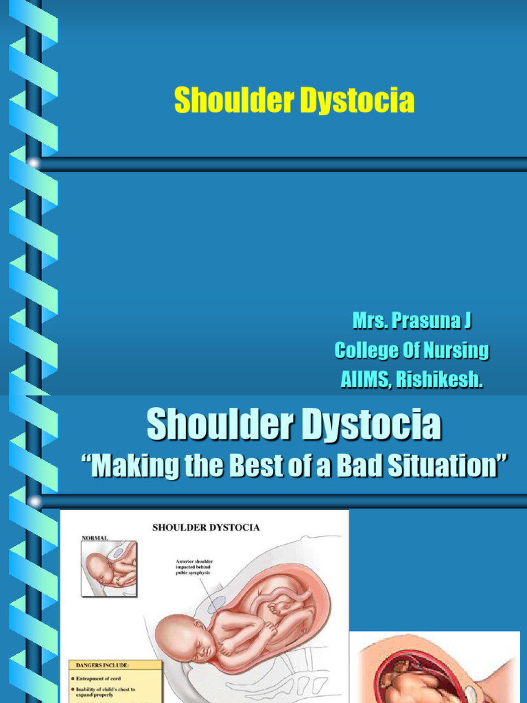 Understanding Shoulder Dystocia Management | PDF | Childbirth ...