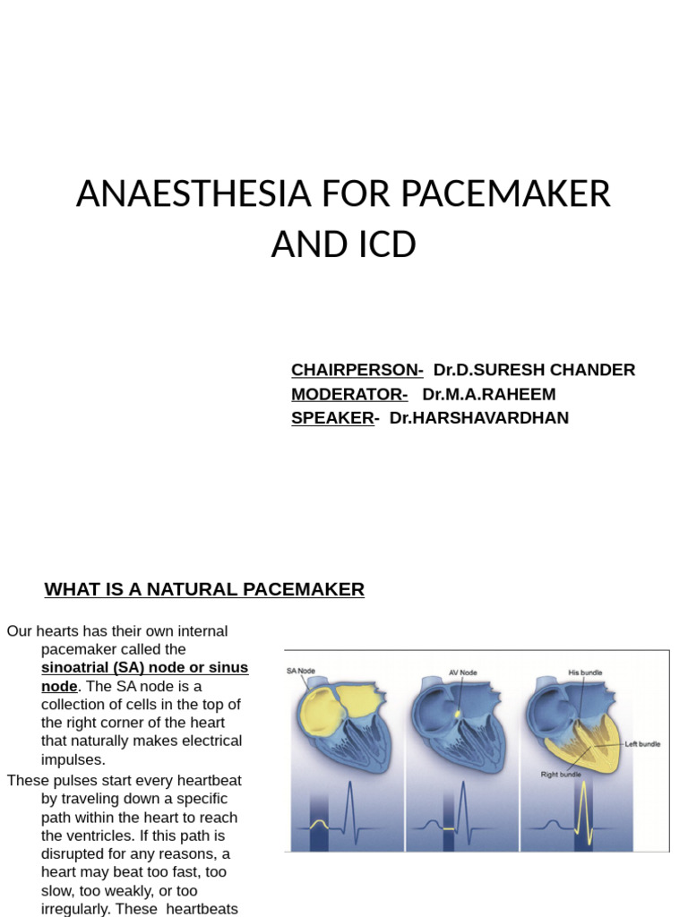 Anaesthesia For Pacemaker and Icd (Autosaved) | PDF | Heart | Cardiac ...