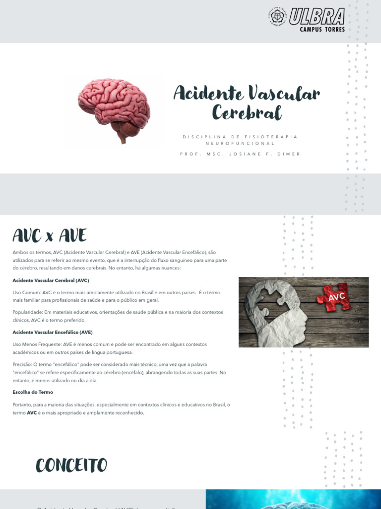 AVC | PDF | AVC | Isquemia