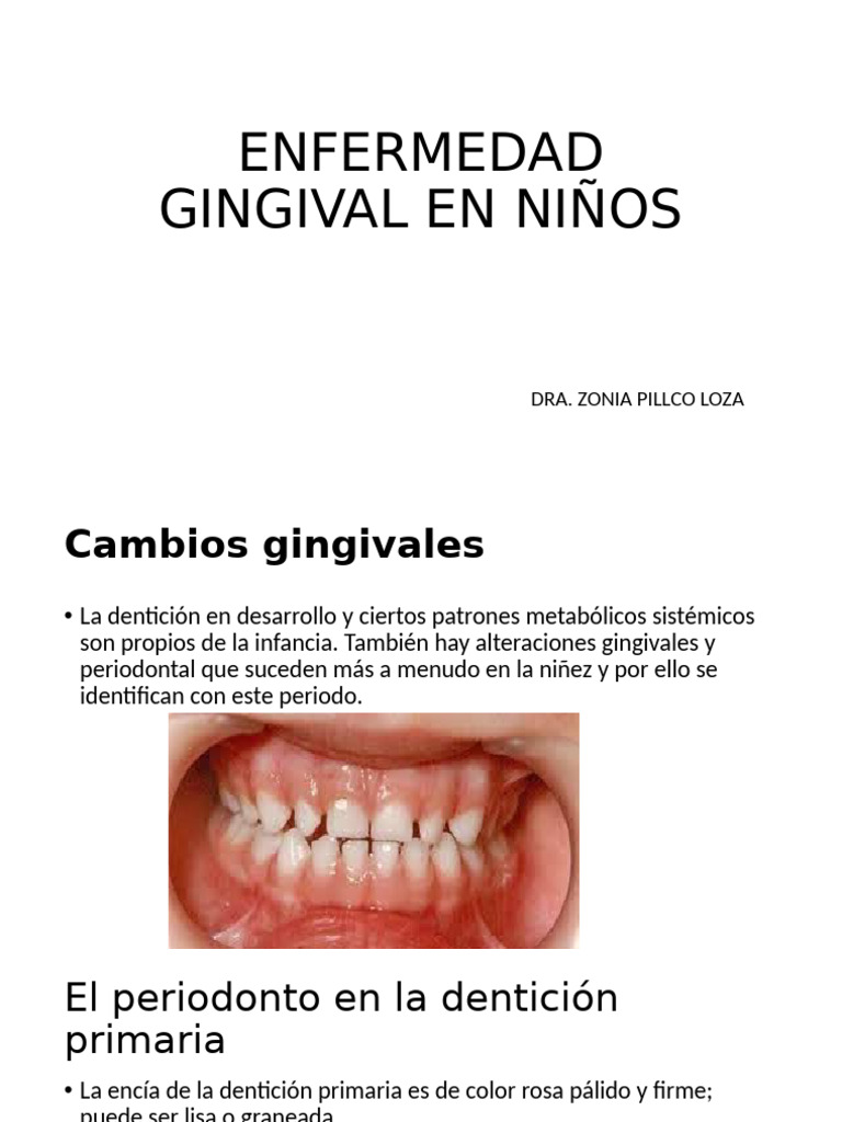 ENFERMEDAD GINGIVAL EN NIÑOS pERIO II 2parcial | PDF | Diente | Odontología