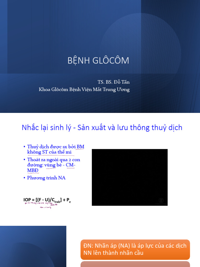Glocom | PDF