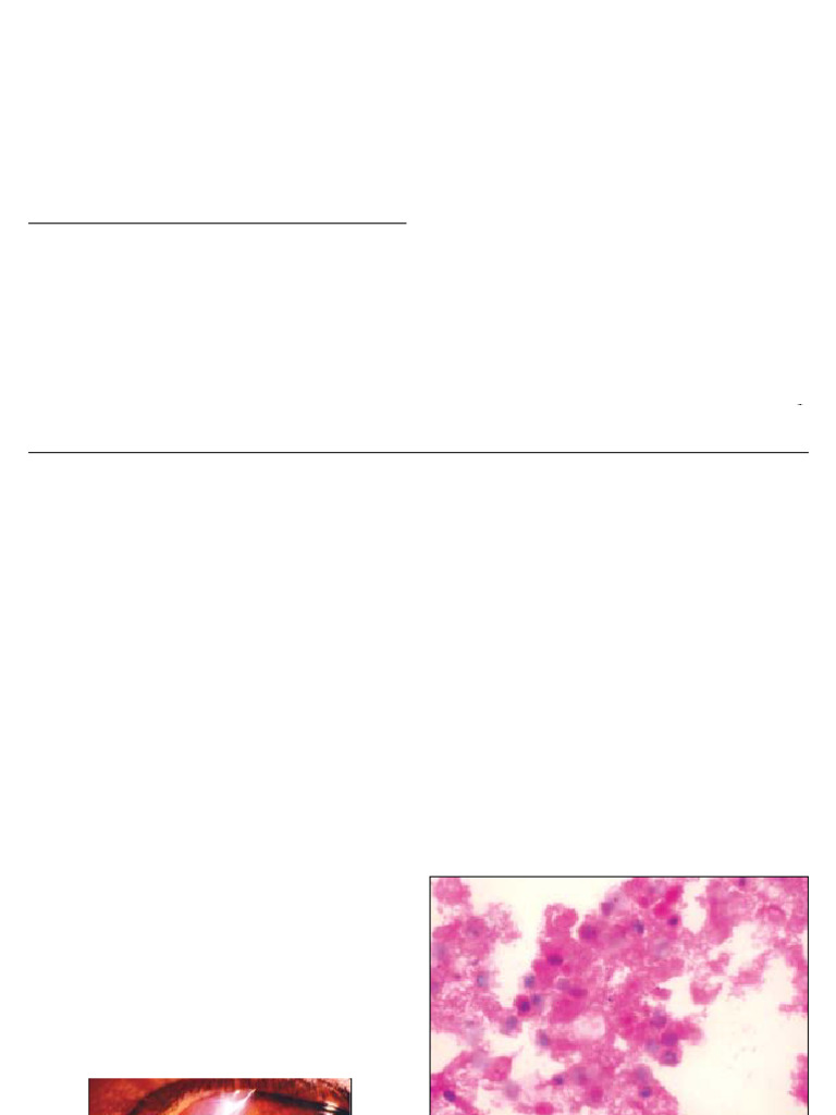Bài 10 Spontaneous - Onset - Corneoscleral - Hematic - Cyst.10 | PDF ...