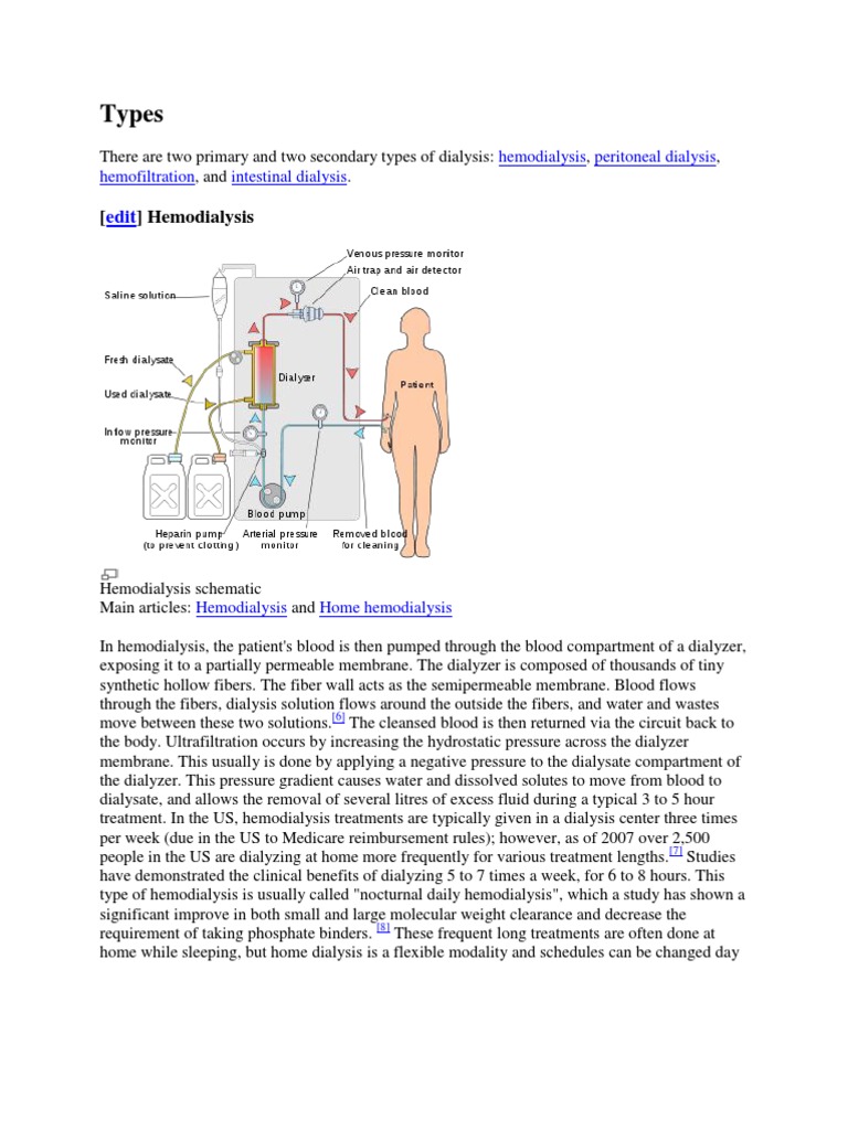 Types | Dialysis | Hemodialysis