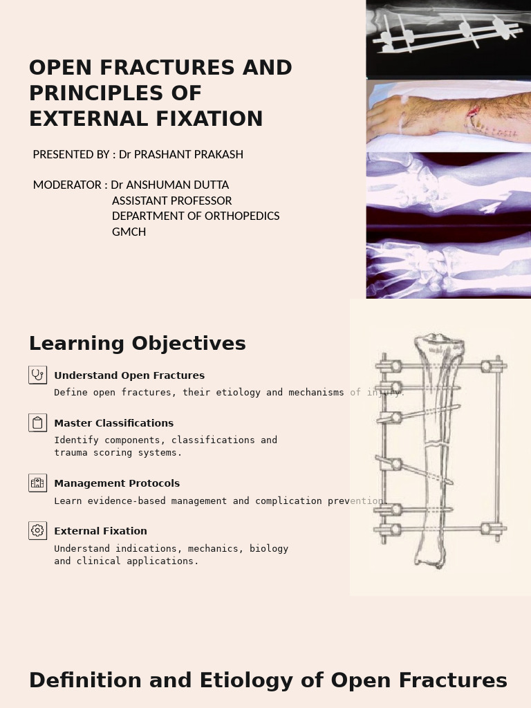 Open Fractures & External Fixation Guide | PDF | Wound | Knee