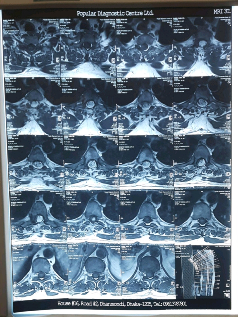 New MRI & Report Present Time | PDF