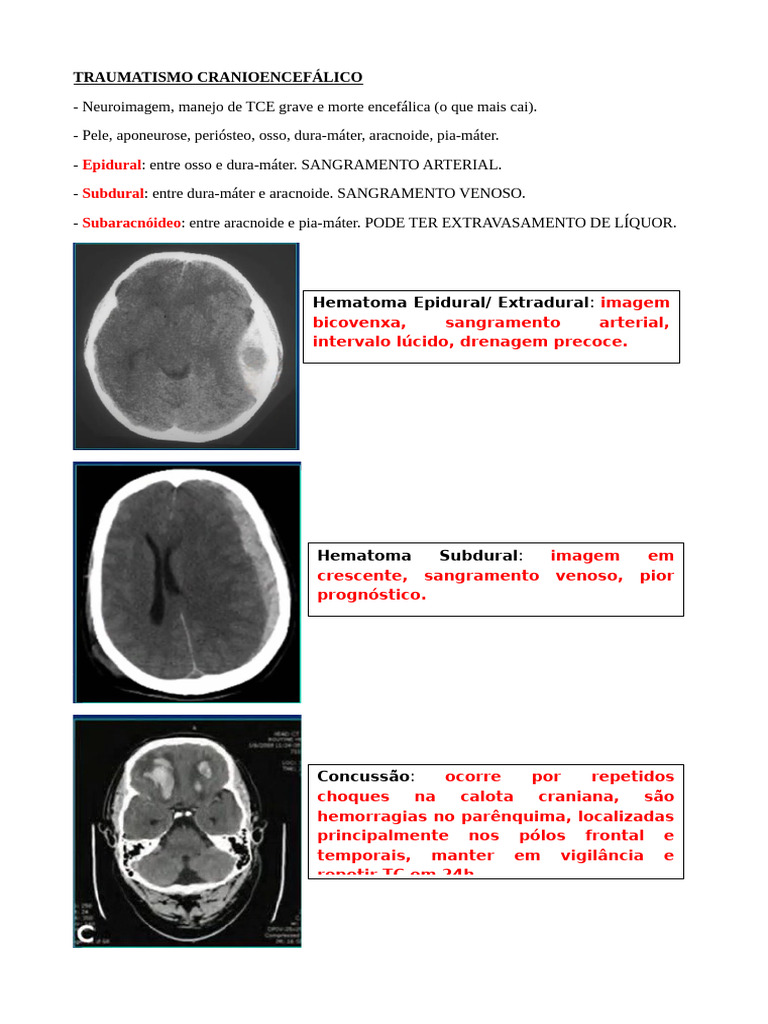 Manejo e Diagnóstico do TCE Grave | PDF | Traumatismo craniano ...