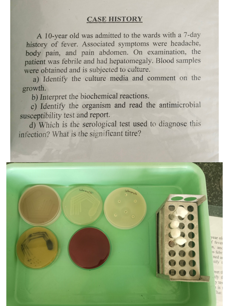Typhoid Case | PDF