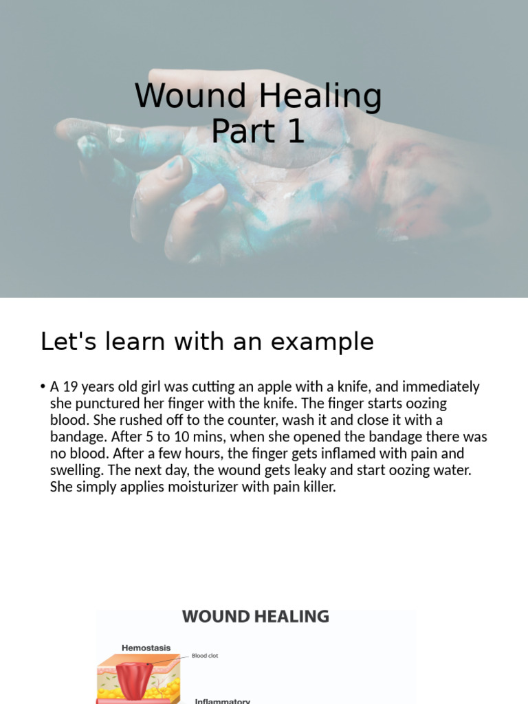 2.wound Healing, Lecture 1 | PDF | Wound Healing | Extracellular Matrix