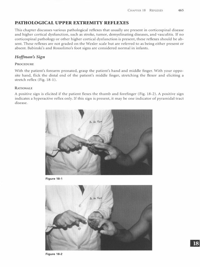Pathological Reflexes in Neurology | PDF | Foot | Hand