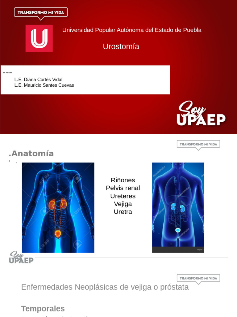 Urostomia | PDF