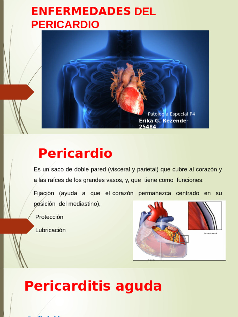 Enfermedades del Pericardio: Guía Completa | PDF | Especialidades ...