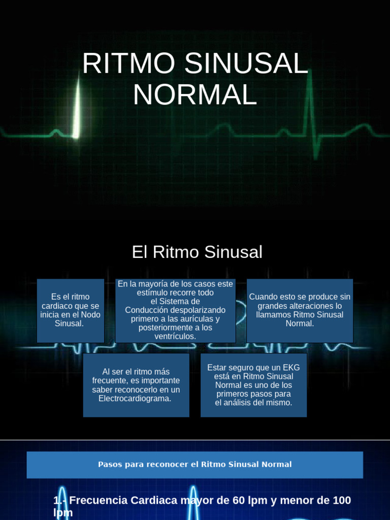 3.-Ritmo Sinusal Normal | PDF | Enfermedades cardiovasculares ...