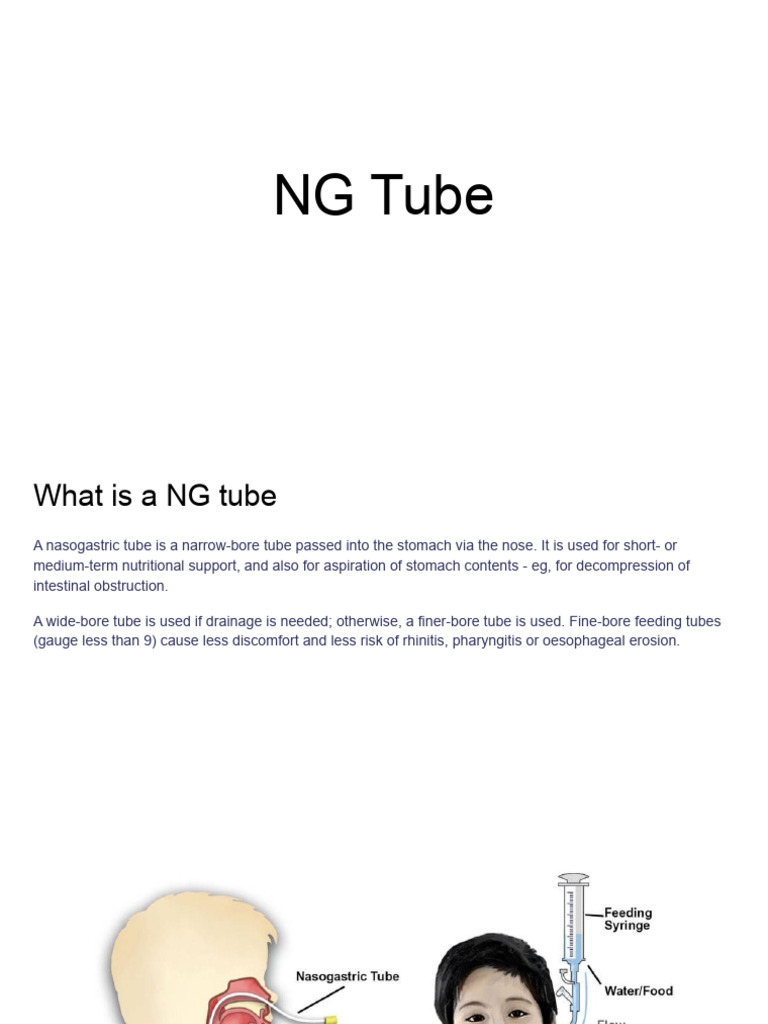NG Tube | PDF