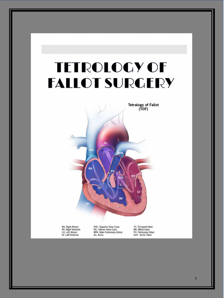 Tetrology of Fallot Surgery | PDF | Congenital Heart Defect | Heart